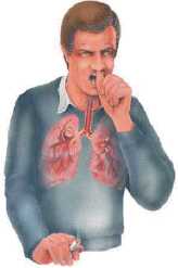 Muestra de Esputo. | APUNTES AUXILIAR ENFERMERIA