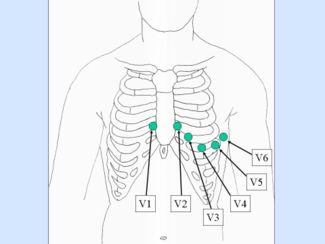 El Electrocardiograma | APUNTES AUXILIAR ENFERMERIA