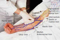 Nursing Procedures: Venipuncture