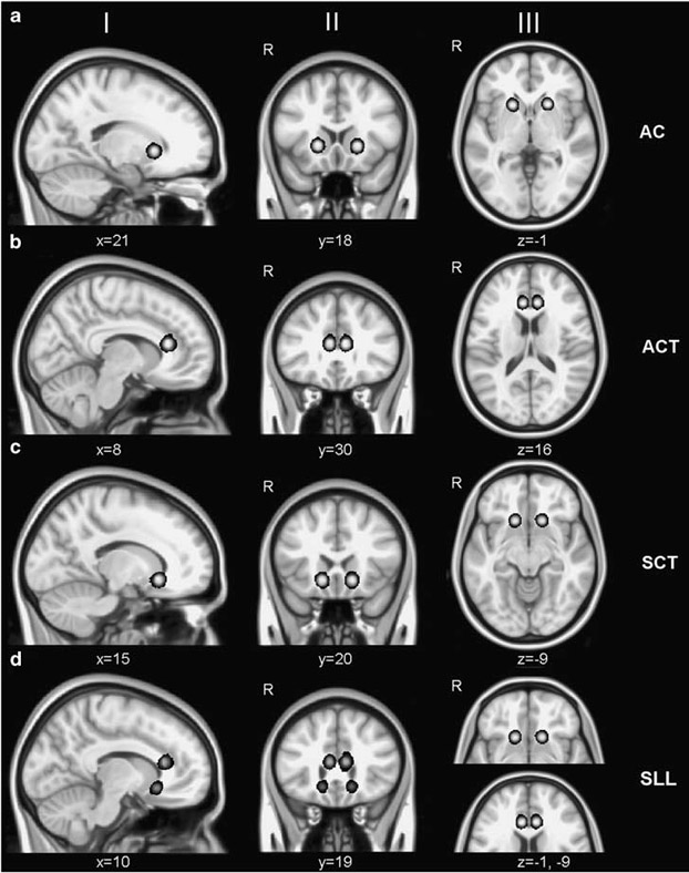The Neurocritic: Modern Tract-Tracing for Historical Psychosurgery