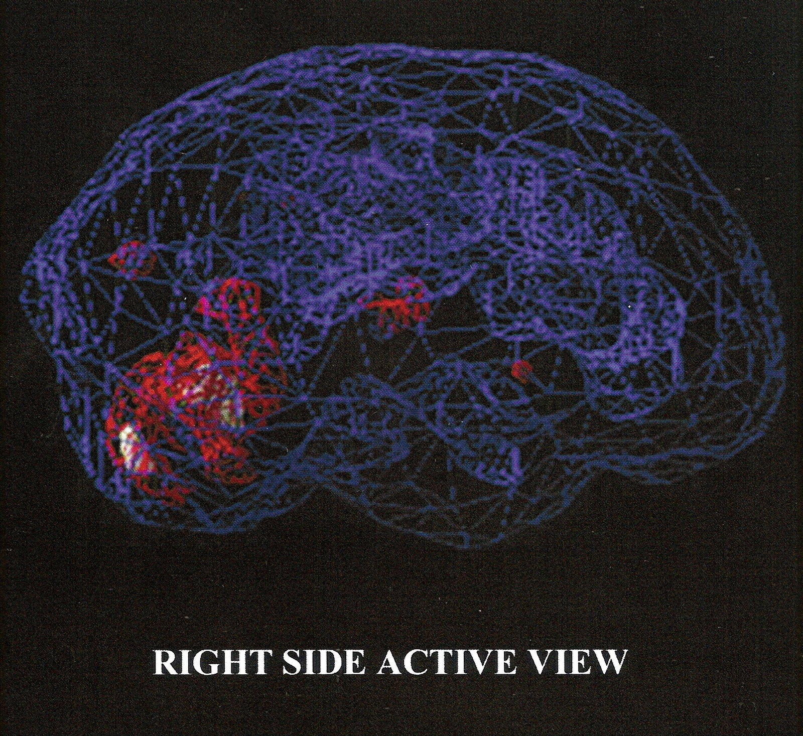 Escape from Depression: Chapter 13: My Brain Scans; Inside Active View