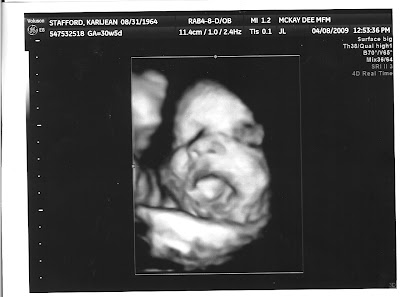 The Stafford Family: 3D Ultrasound Shots-30 Weeks