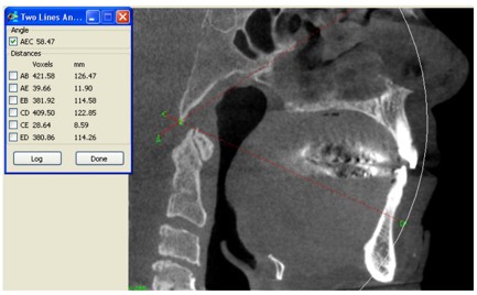 Facial Development Newsletter: HOW DO WE EVALUATE A PATIENT FOR ...