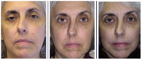 Facial Development Newsletter: THE FACE and THE AIRWAY, GENE ...