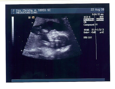 24 weeks pregnant 4d ultrasound - neuport