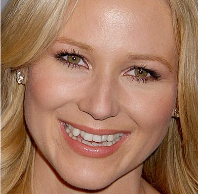 Celebrity Yak: Ugly Celebrity Smiles!