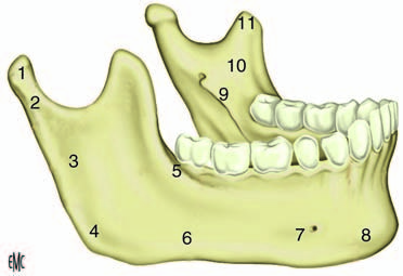 Les fractures mandibulaires