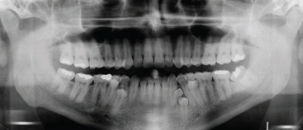 Les anomalies dentaires.