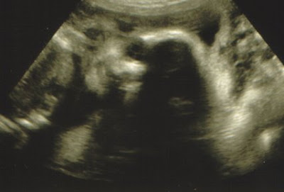 April's Little Family: This is What My 26 Week Fetus Looks Like. In ...