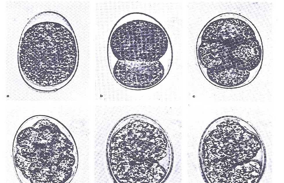 ParasiDiario: EVOLUCIÓN DE LOS HUEVOS DE UNCINARIA