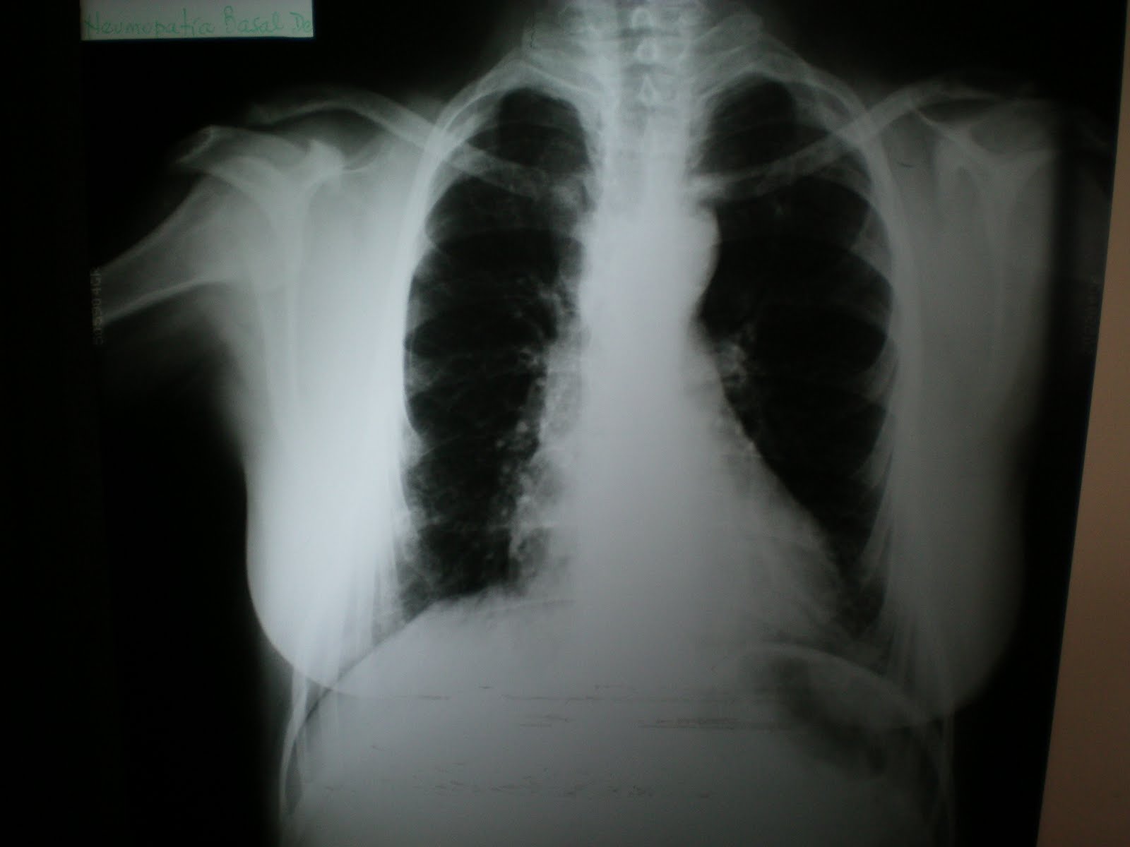 RXDOMINICOS: 09/13/10