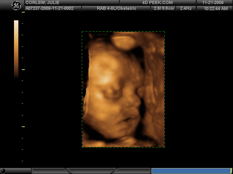 1st Timer's Journey: 28 week 3d/4d ultrasound