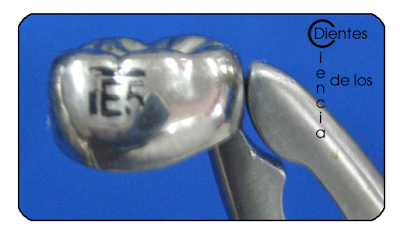 Figura 14.- Adaptacion con pinzas de abombar