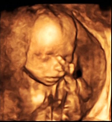 Baby Lanterme: 22 week scan