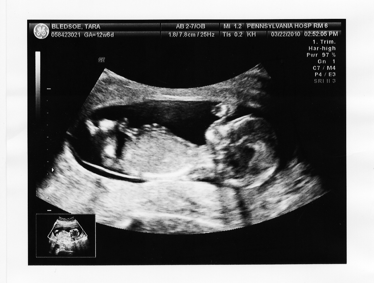 Kyle and Tara Forever: 13 Weeks