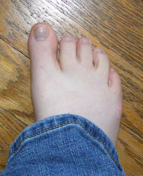 Something New: I don't have mutant feet! I just don't!