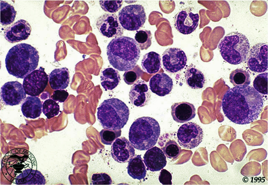ATLAS DE HEMATOLOGIA: LEUCOCITOS
