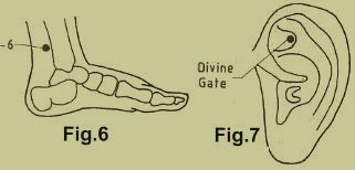 ACUPRESSURE AND ACUPUNCTURE THERAPY: Important points for relieving ...