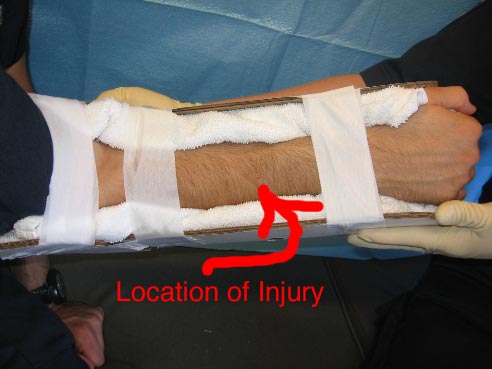 Grey Ops: First Aid: Splinting