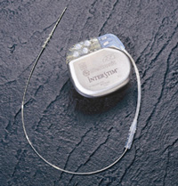 InterStim update, 34 days since stage 2 surgery | Random Thoughts