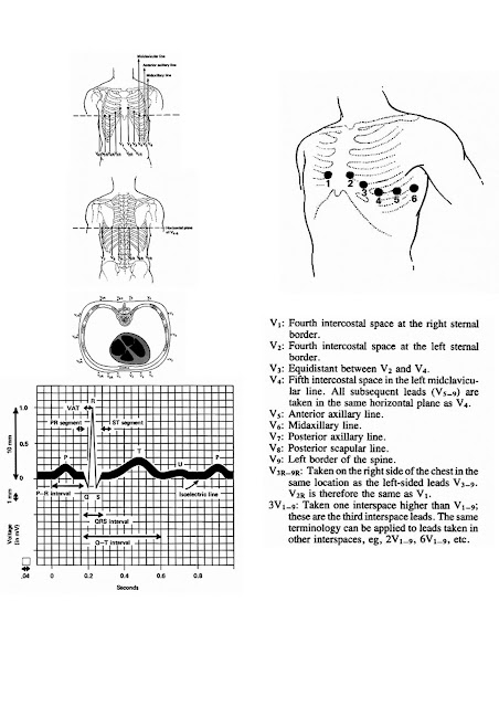 CARA PASANG EKG-how to install EKG