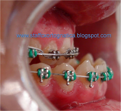 Staff 1 de Diciembre de 2008