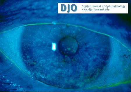 Dr. Iman: OSCE Ophthalmology