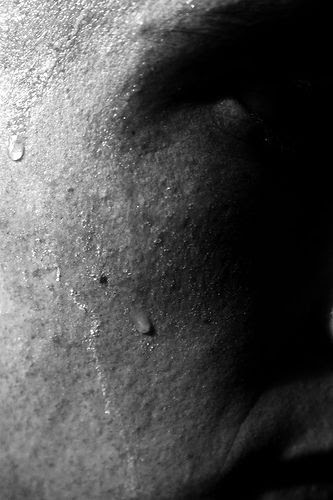 CasesBlog - Medical and Health Blog: Why would a person have pink sweat ...