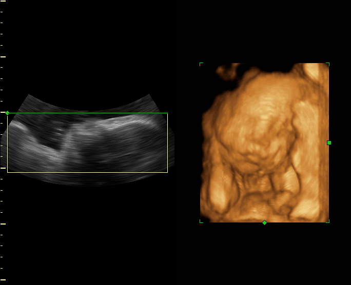 MAROKI: My first Experience on 4-dimension USG