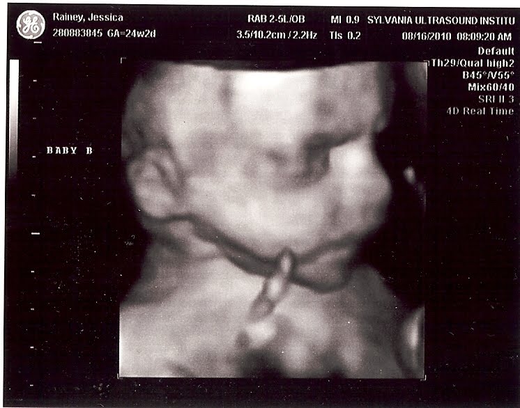 Raising the Rainey Twins: Week 24 Ultrasound: Still Girls, Now 100%