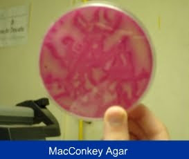 Escherichia Coli: Diagnóstico del laboratorio