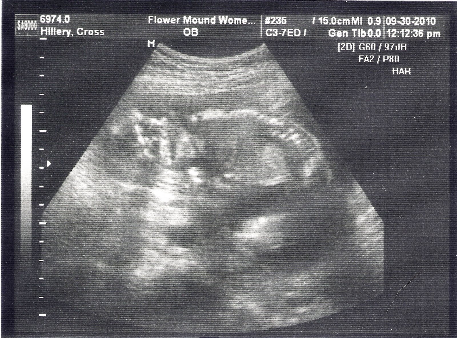 At Home With The Cross Family: updated Baby pictures at 18 weeks