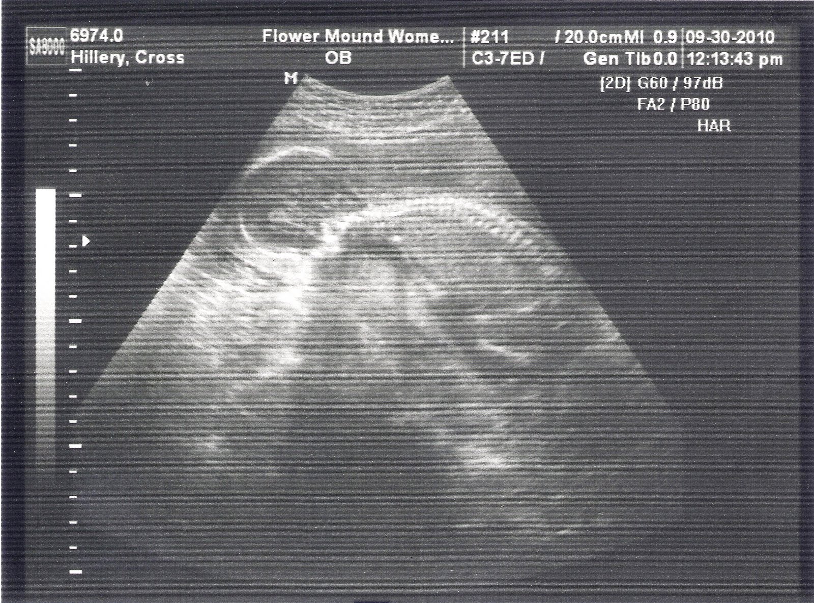 At Home With The Cross Family: updated Baby pictures at 18 weeks