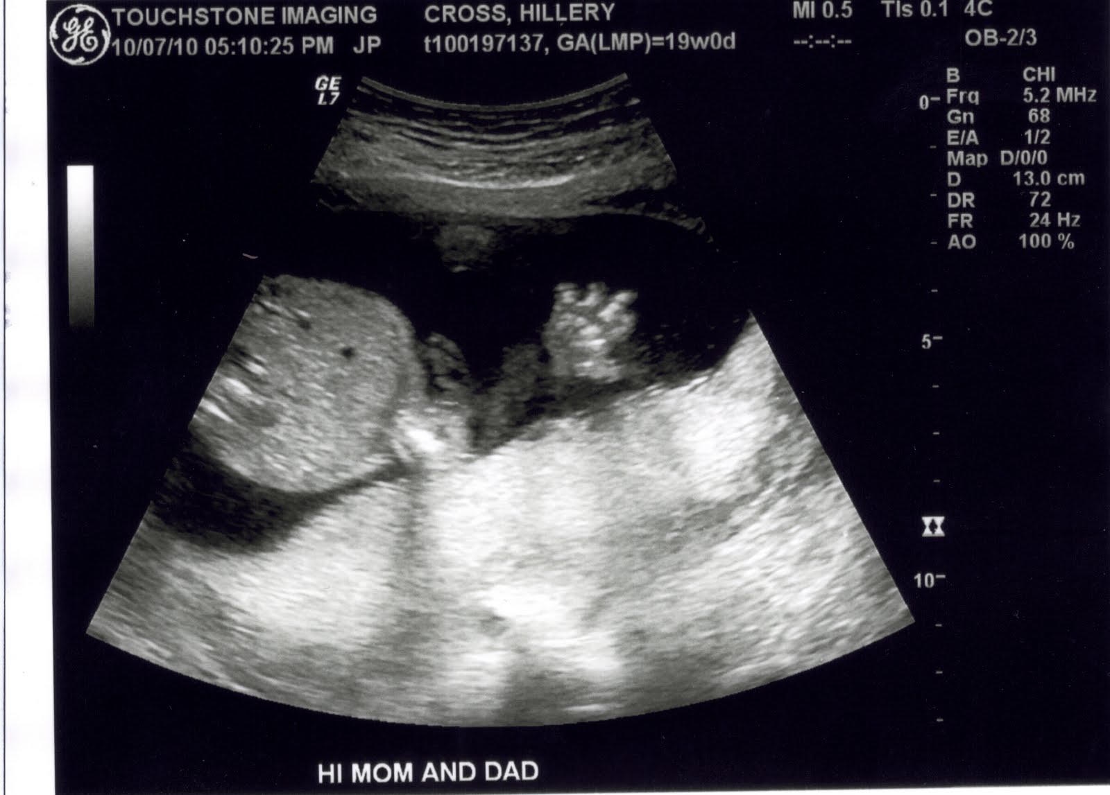 At Home With The Cross Family: 19 week ultrasound photos