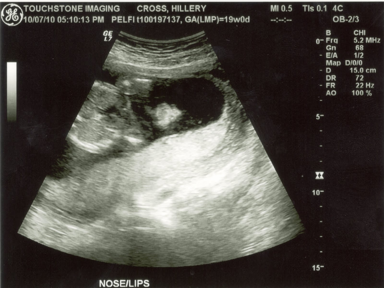 At Home With The Cross Family: 19 week ultrasound photos
