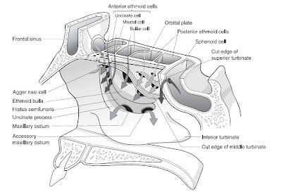 Medical Textbook in The Net: Sinusitis