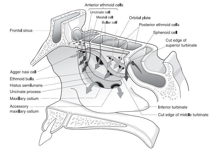 Medical Textbook in The Net: Sinusitis