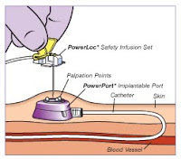 The Dirty Pink UnderBelly: The Bard purple Power Port