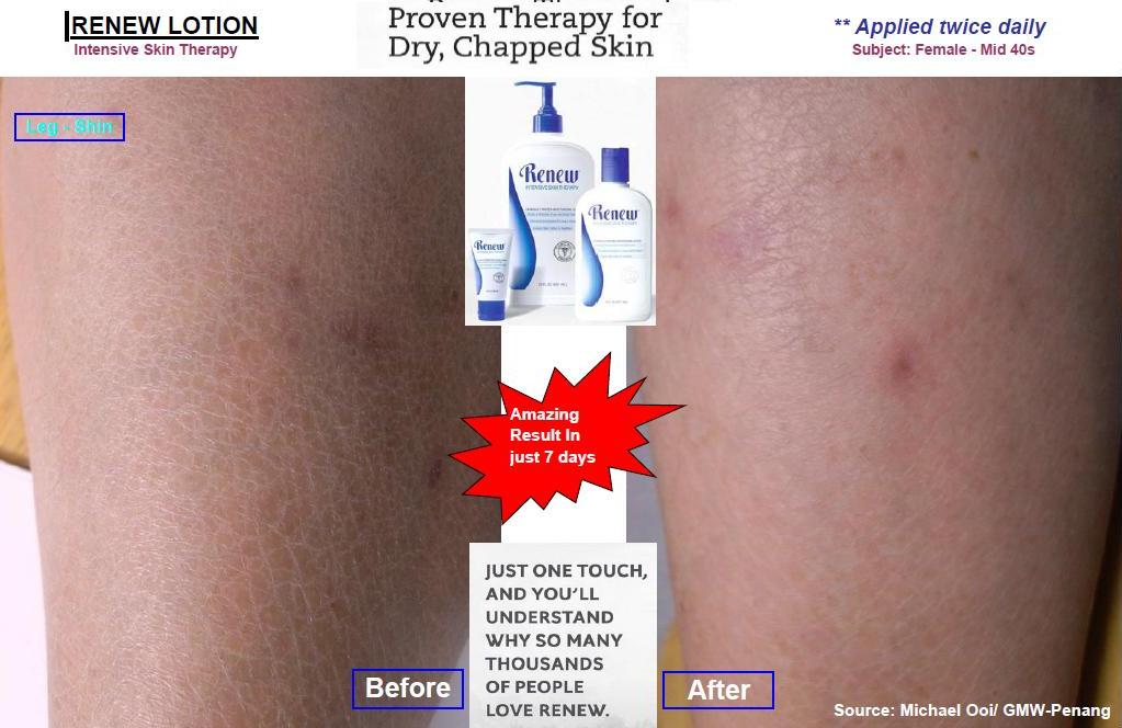 Melaleuca - A Wellness Company: Product Testimony - Renew Lotion ...