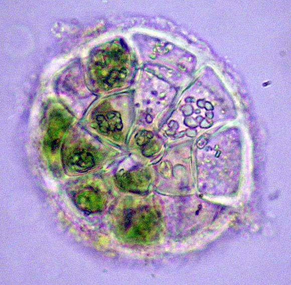 Beyond the Human Eye: Pond scum