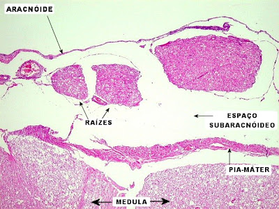 Sistema Nervoso: Aracnóide do encéfalo