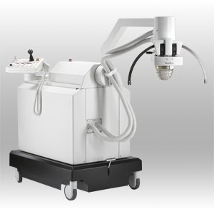 Achilles Rehab: Everything Explained, The Orthotripsy Procedure