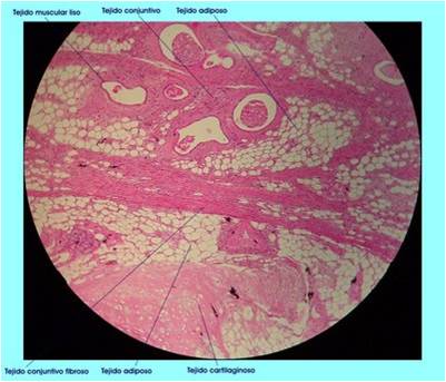 Curso de Histologia_odontologia: Tejido conectivo laxo