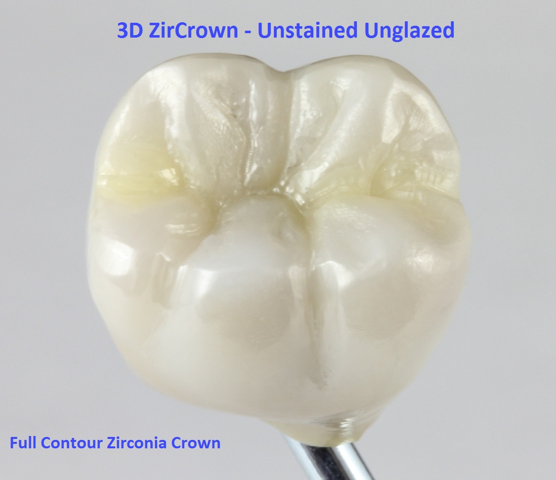 Kastle Mills Digital Dentistry Korner - Your Source for Intraoral and ...