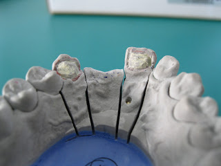 DENTO CARE DENTAL CLINICS: MARYLAND BRIDGE