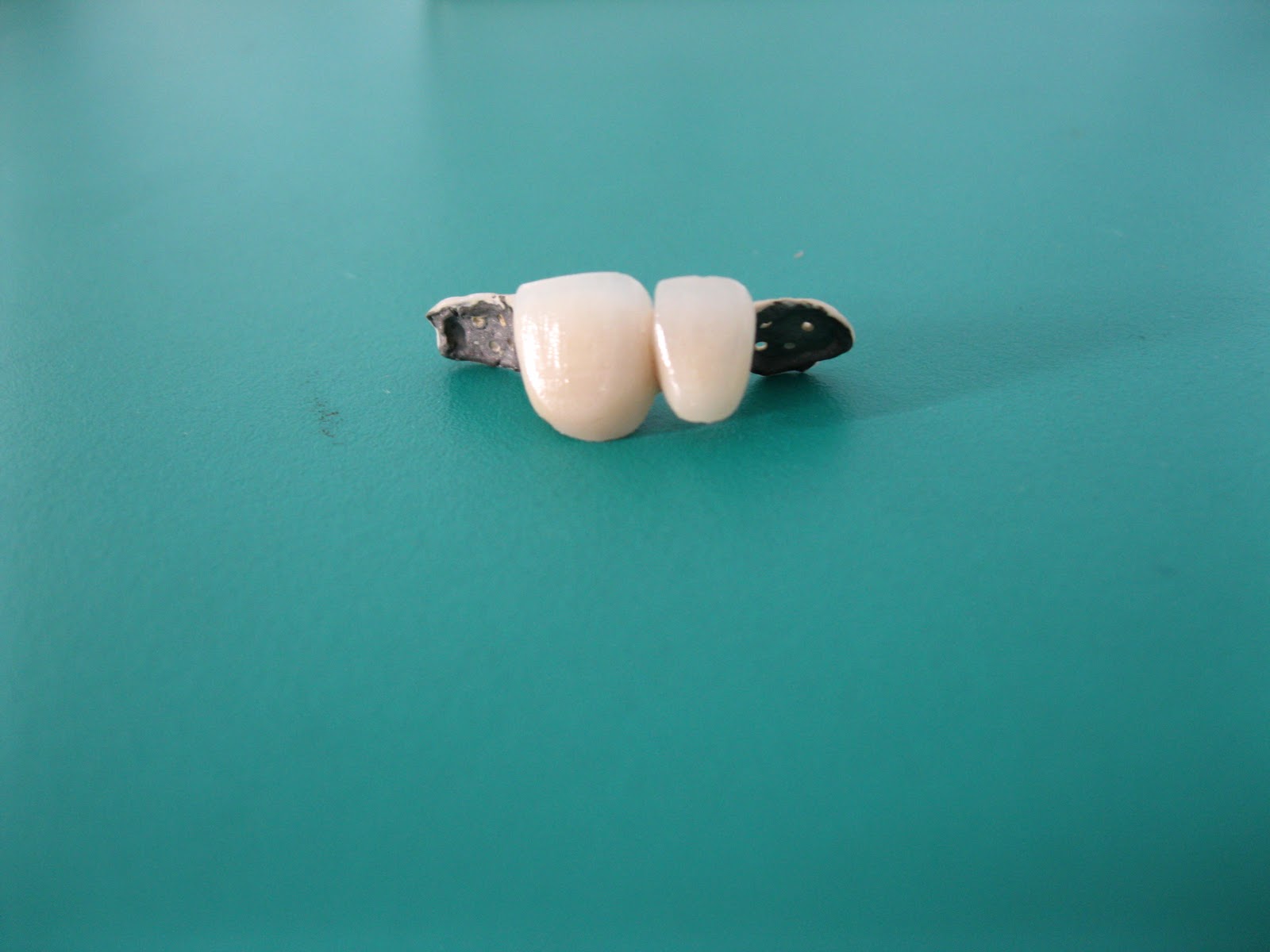 DENTO CARE DENTAL CLINICS: MARYLAND BRIDGE