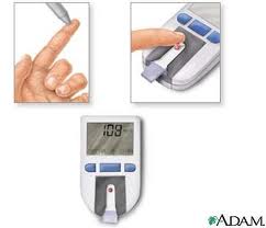 Técnicas de enfermería: Glucemia capilar