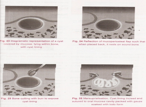 Médecine et Chirurgie Buccales