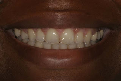 Philadelphia Periodontist | Periodontist Phladelphia | Philadelphia Gum ...