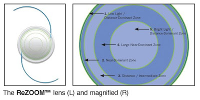 CLINICA DE OJOS DR. JORGE TEJEDA GRATTA: Lentes intraoculares ...